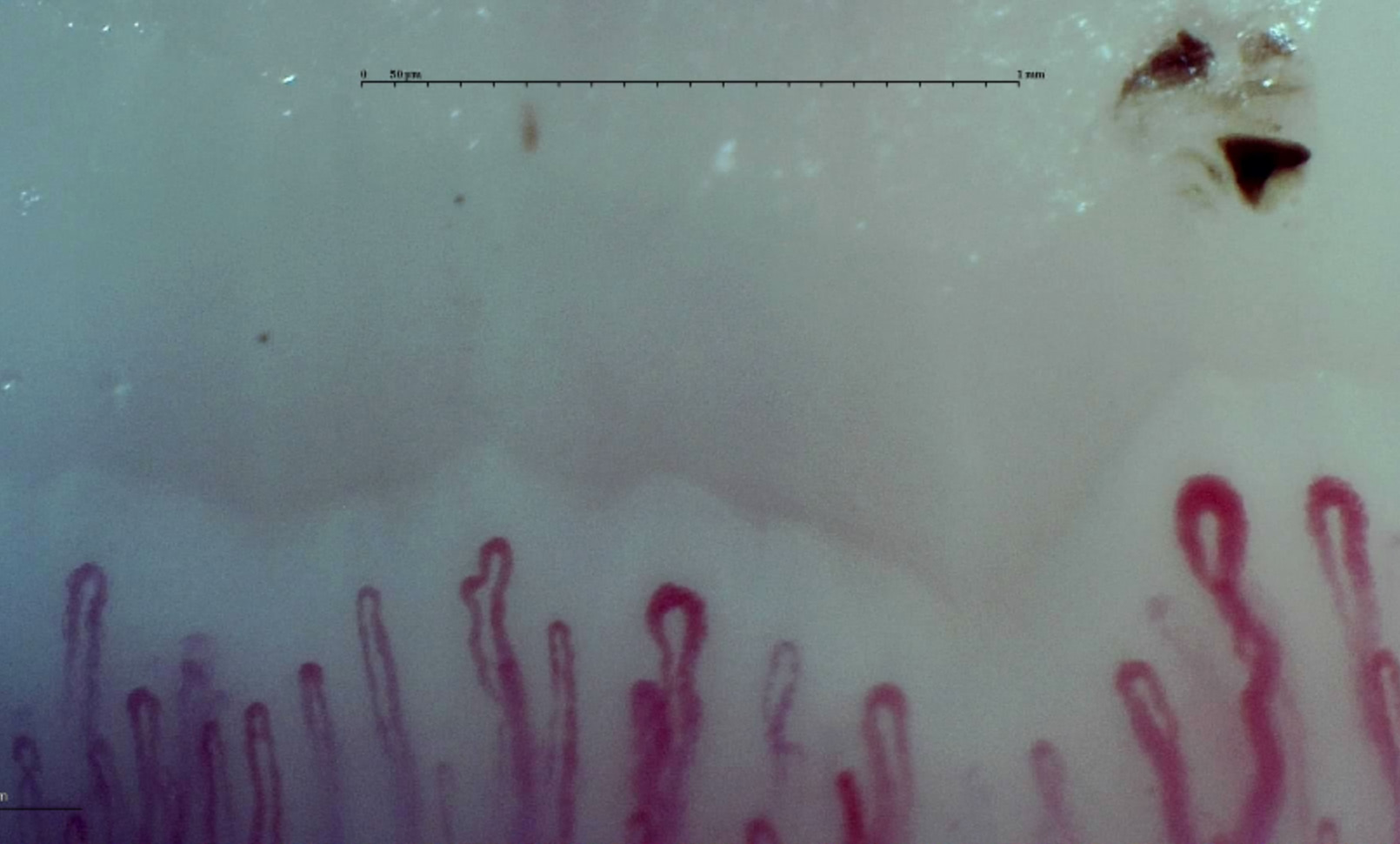 Capillary.io: Precision capillaroscopy powered by AI